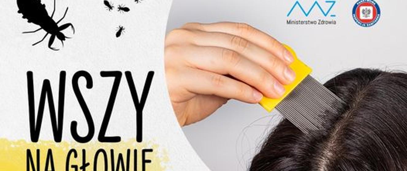 Wszy na głowie – pasożyty zewnętrzne - Powiatowa Stacja Sanitarno ...